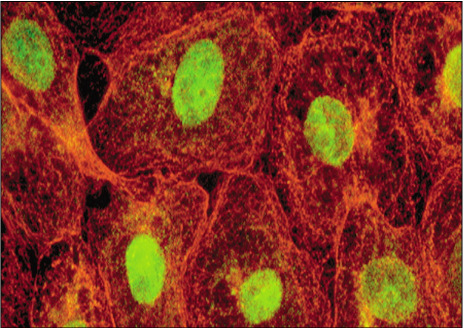 immunostaining-immunostaining